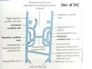 Development of Major Vessels. | PPT