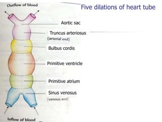 Development of Major Vessels. | PPT