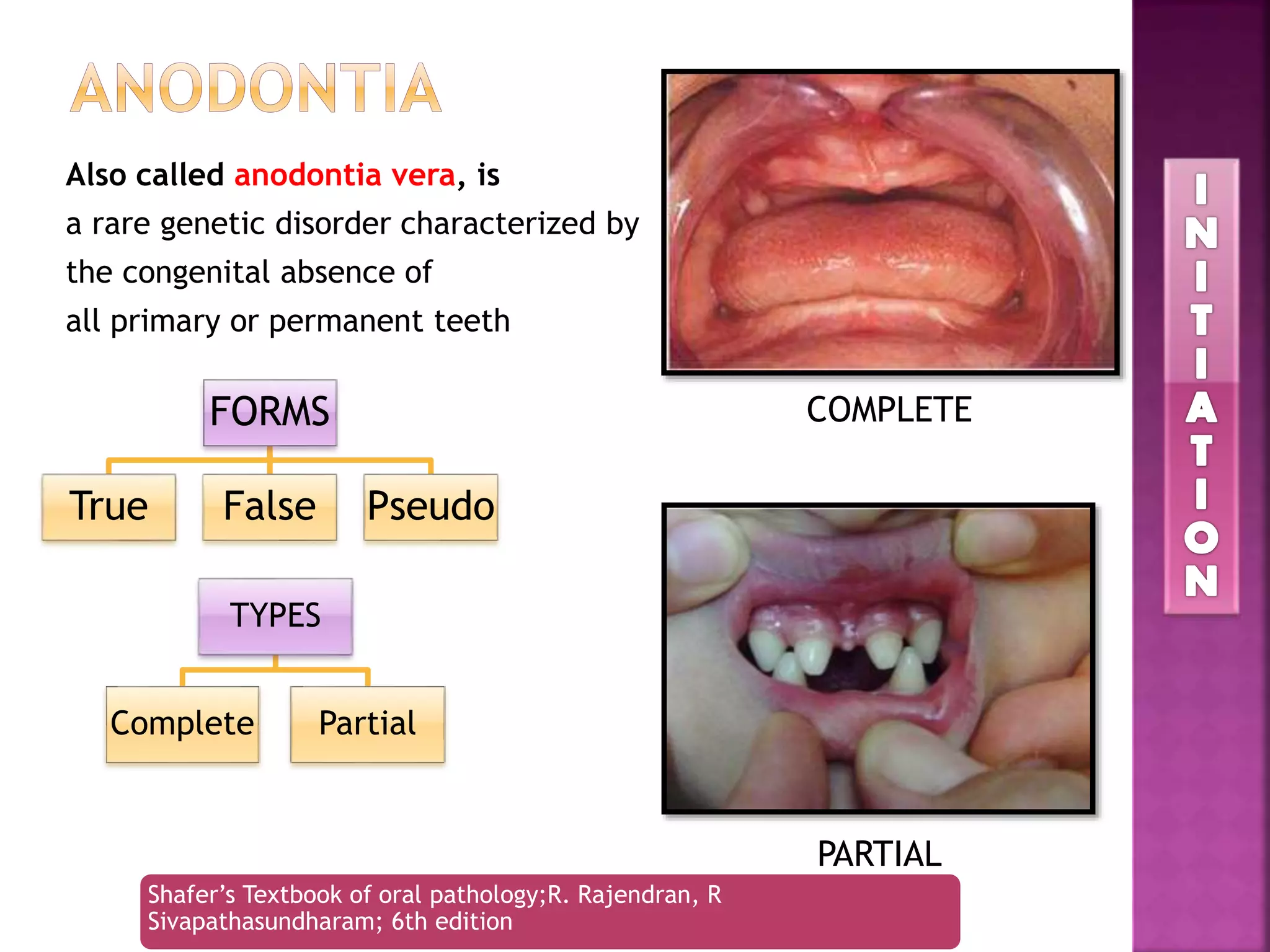 Development of tooth | PPTX