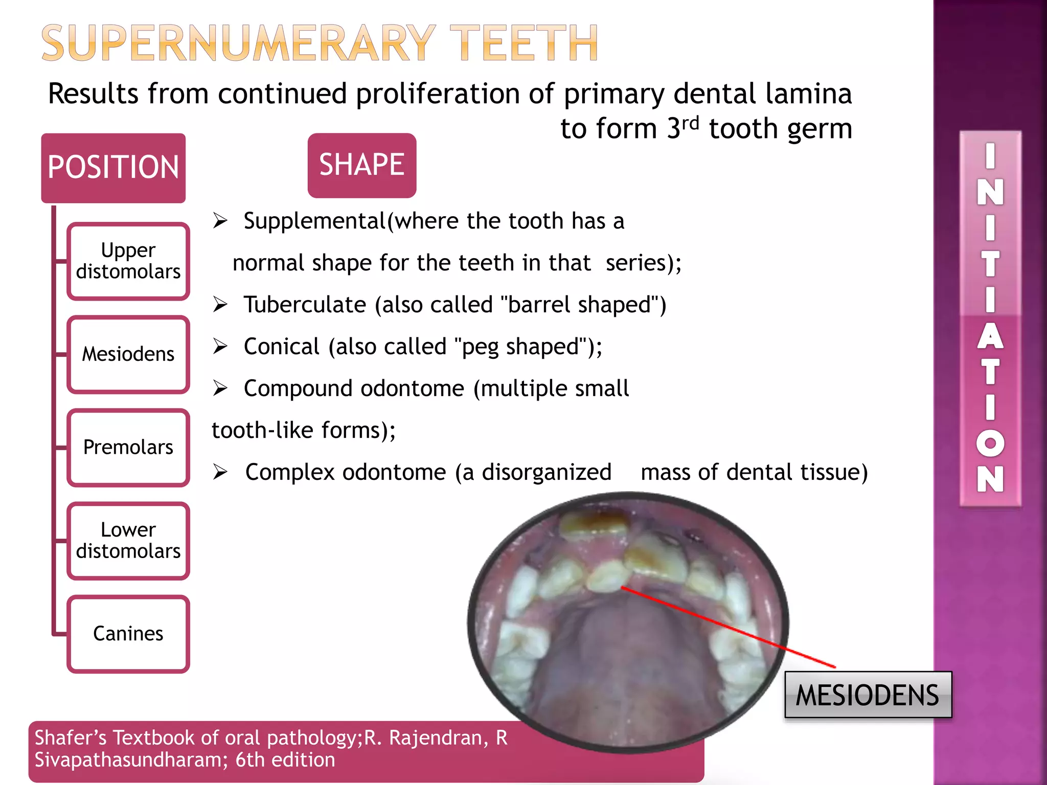 Development of tooth | PPTX
