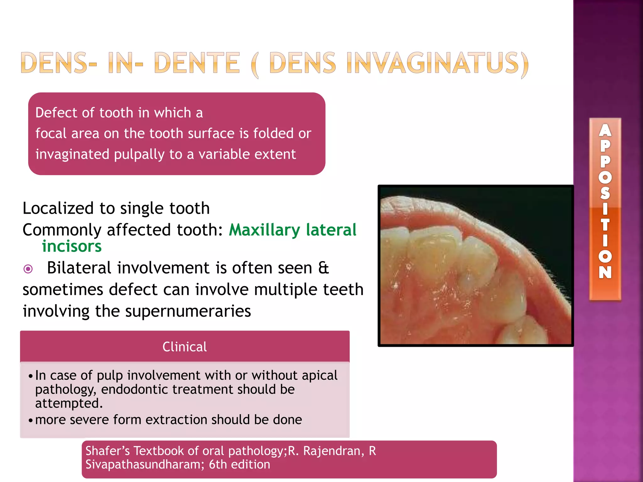Development of tooth | PPTX