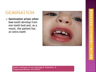 Development of tooth | PPTX