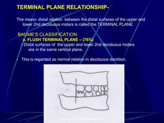 Development of primary dentition /certified fixed orthodontic courses ...