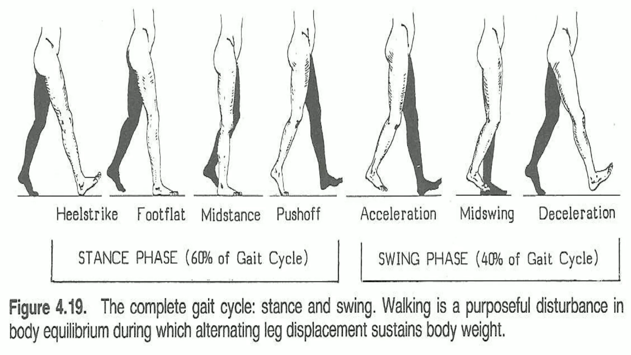Localization And Control Of Gait And Posture Disorders Ppt