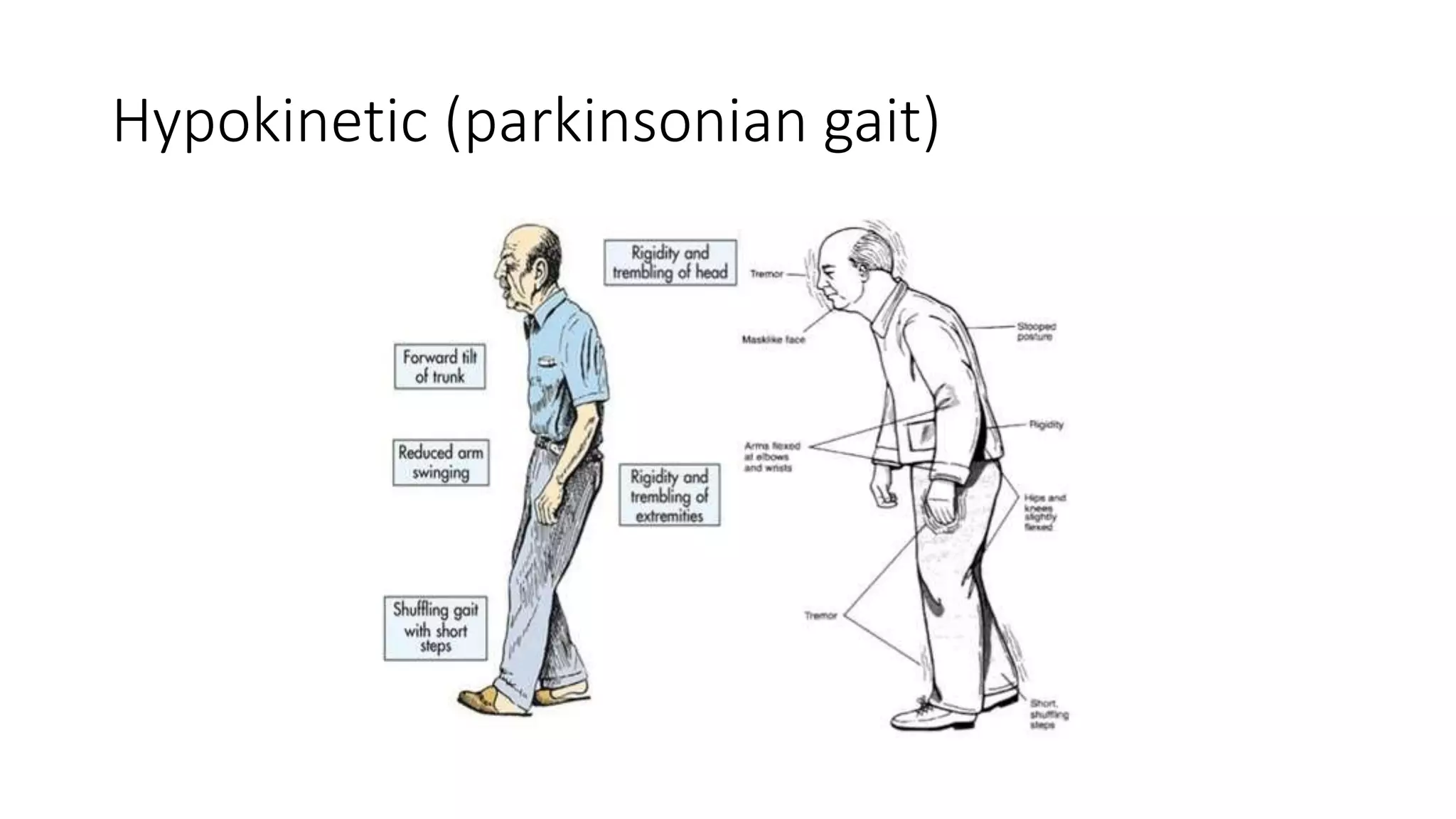 Localization And Control Of Gait And Posture Disorders Ppt