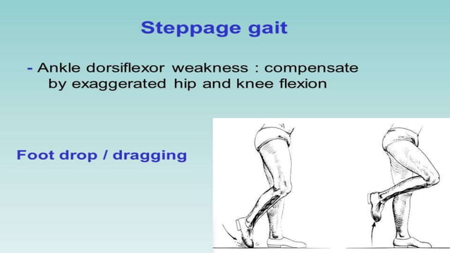 Localization And Control Of Gait And Posture Disorders Ppt