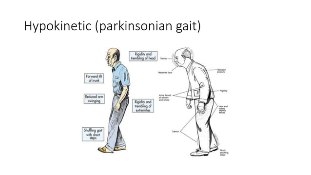 localization and control of gait and posture disorders | PPT