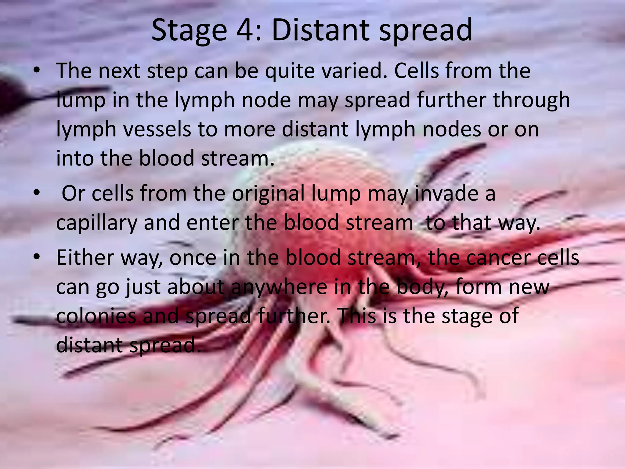 cancer, stages, symptoms | PPTX