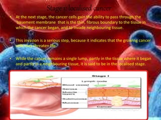 cancer, stages, symptoms | PPTX