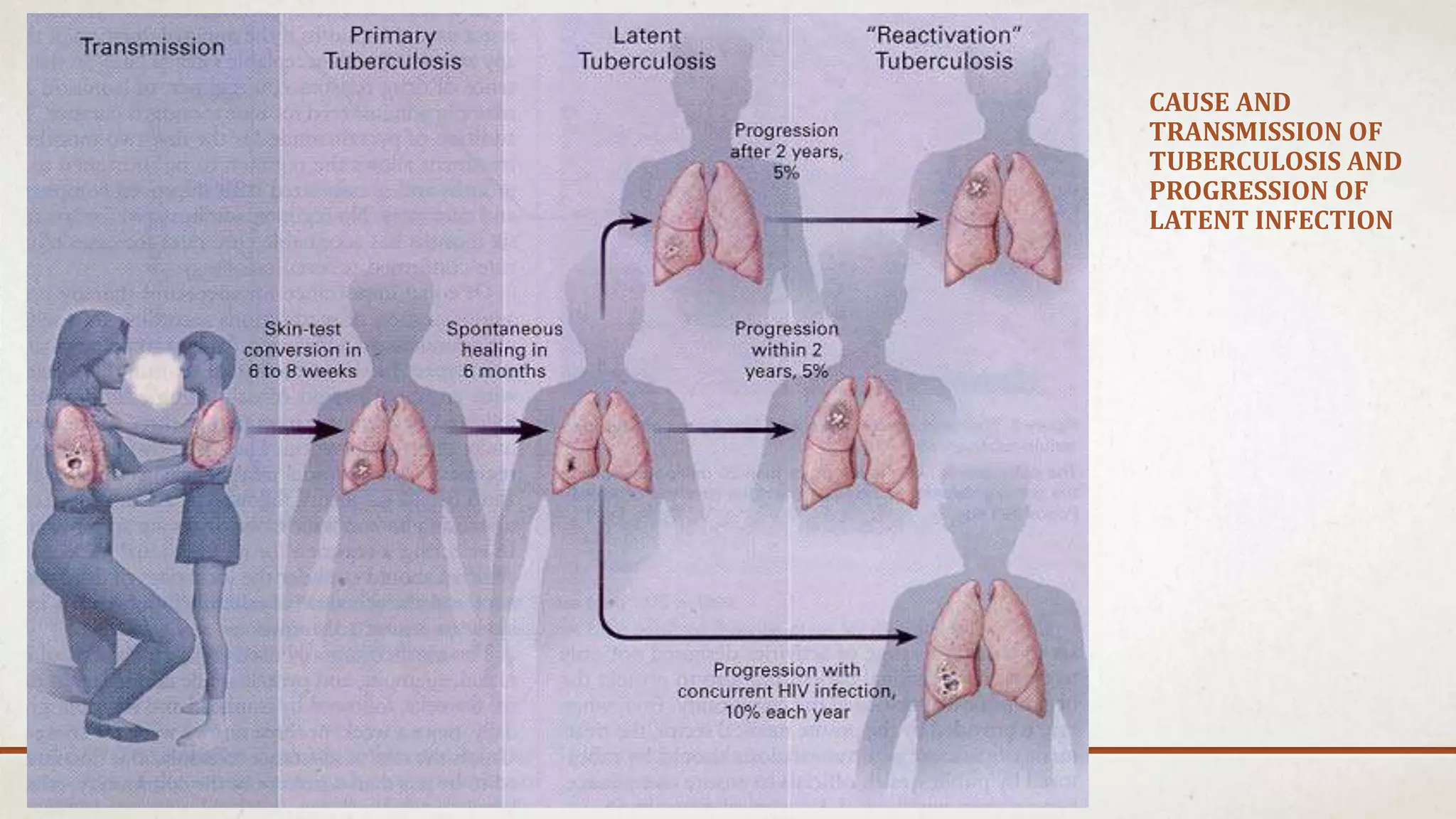 Radiographic manifestations of pulmonary tuberculosis | PPTX