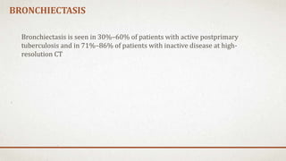 Radiographic manifestations of pulmonary tuberculosis | PPTX