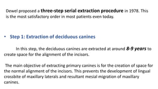 Dewel`s method of serial extraction (interceptive orthodontics).pptx
