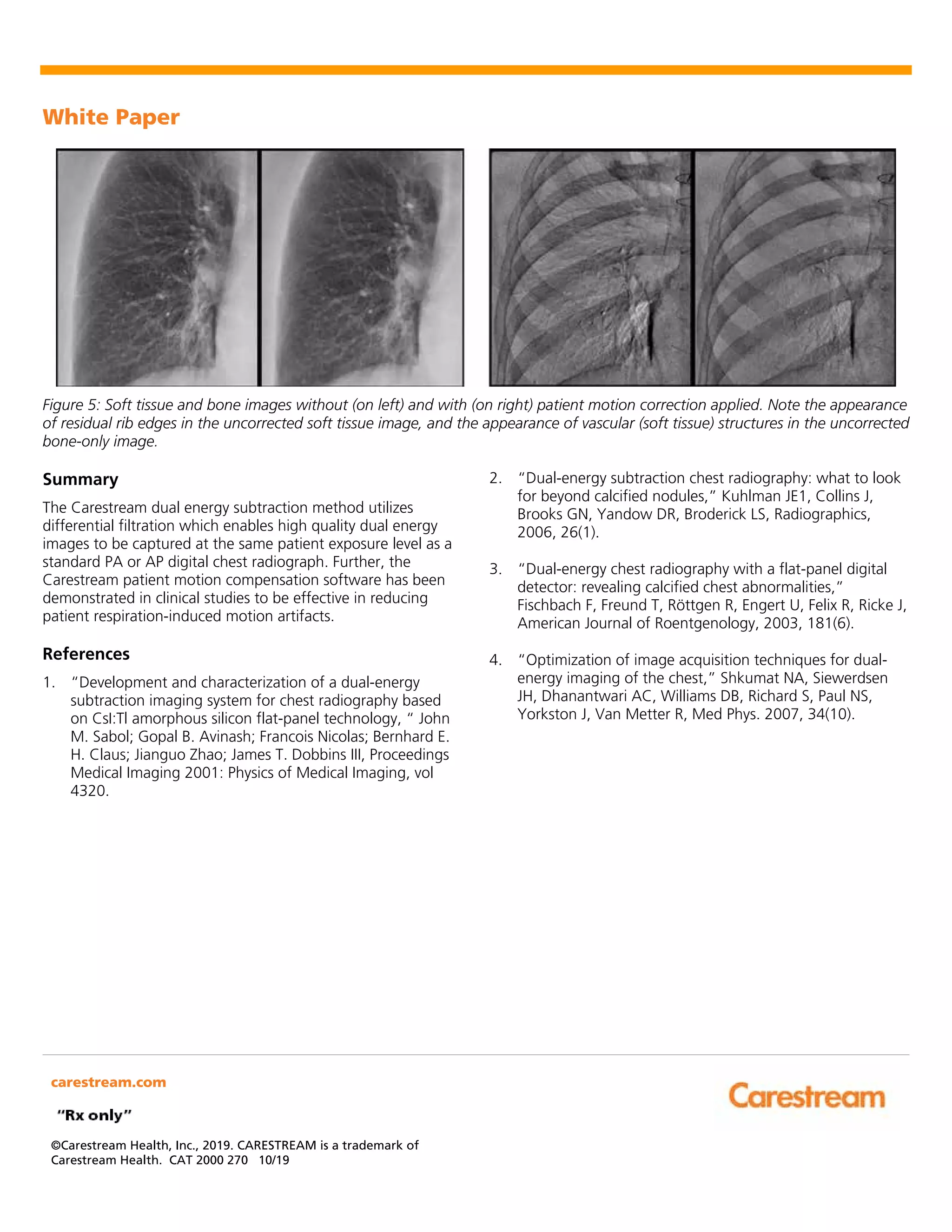 Dose Efficient Dual Energy Subtraction Radiography - Theory of ...