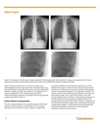 Dose Efficient Dual Energy Subtraction Radiography - Theory of ...