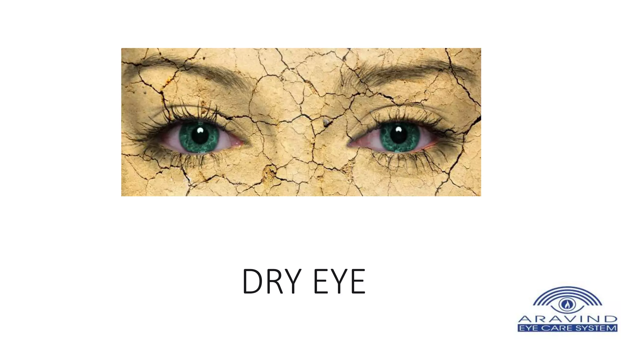 DRY EYE | PPTX
