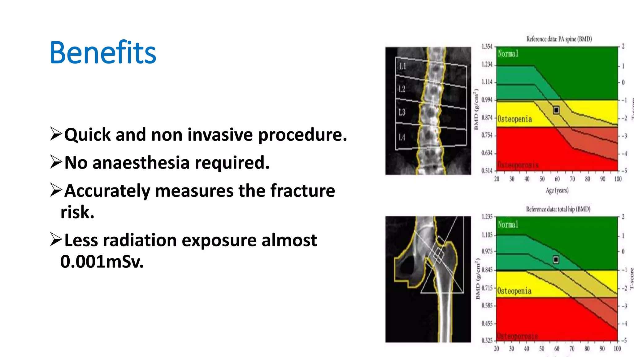 Dexa and its aplication | PPTX