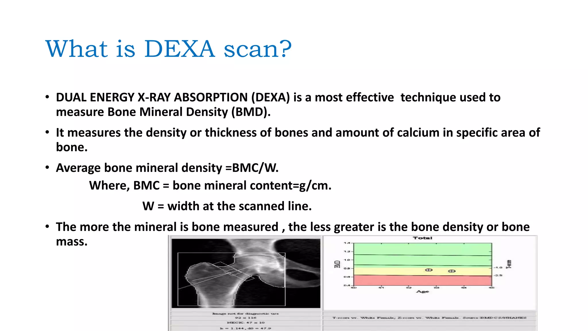 Dexa and its aplication | PPTX
