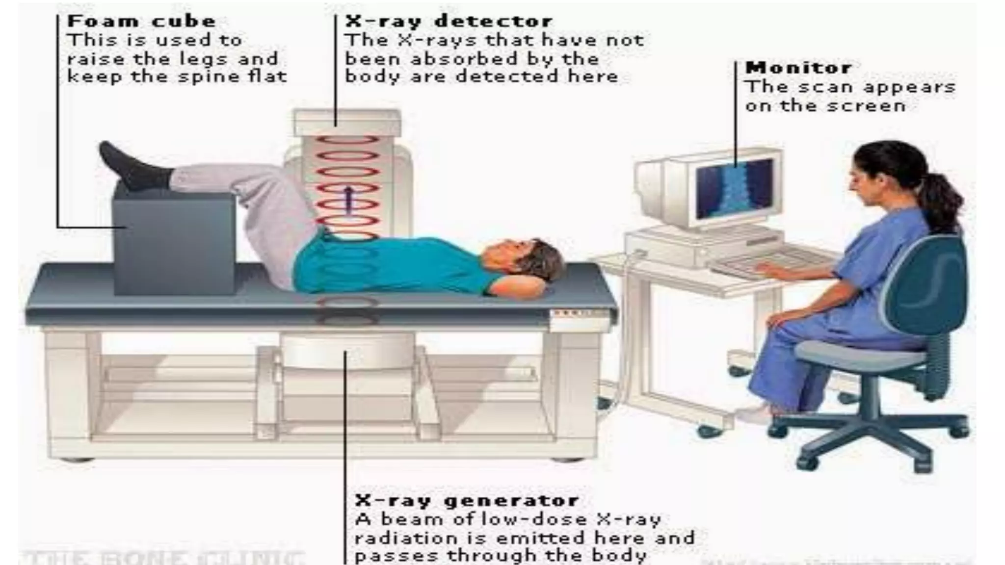 Dexa and its aplication | PPTX