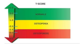 Dexa and its aplication | PPTX