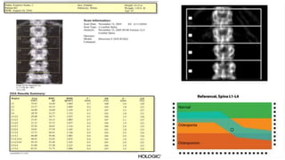 Dexa and its aplication | PPTX