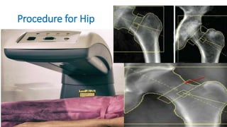 Dexa and its aplication | PPTX
