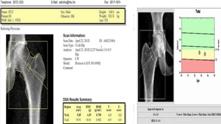 Dexa and its aplication | PPTX