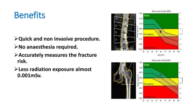 Dexa and its aplication | PPTX | Bone and Joint Conditions | Diseases and Conditions