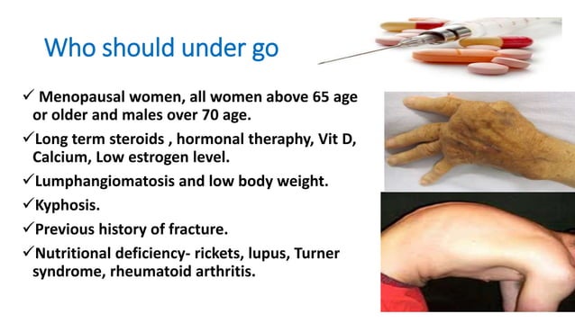 Dexa and its aplication | PPTX | Bone and Joint Conditions | Diseases ...