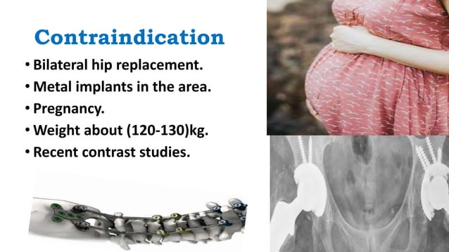 Dexa and its aplication | PPTX | Bone and Joint Conditions | Diseases ...