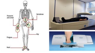 Dexa and its aplication | PPTX