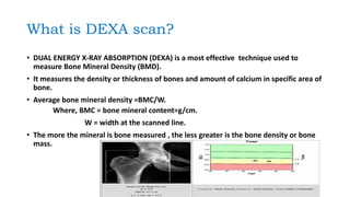 Dexa and its aplication | PPT