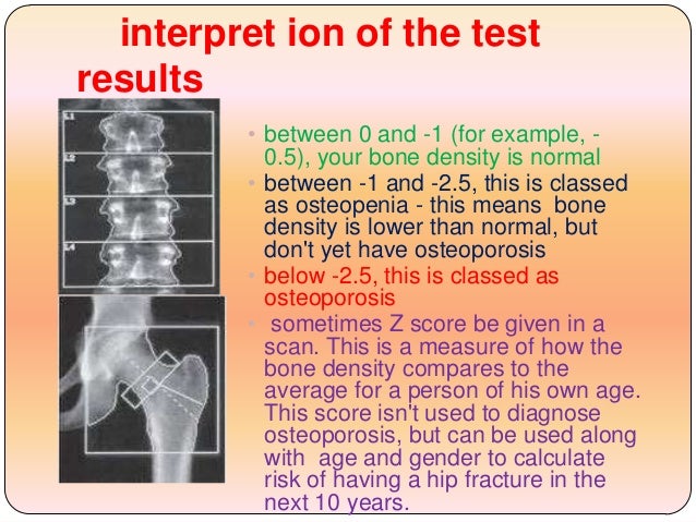 Dexa P ppresent dexa-p-ppresent