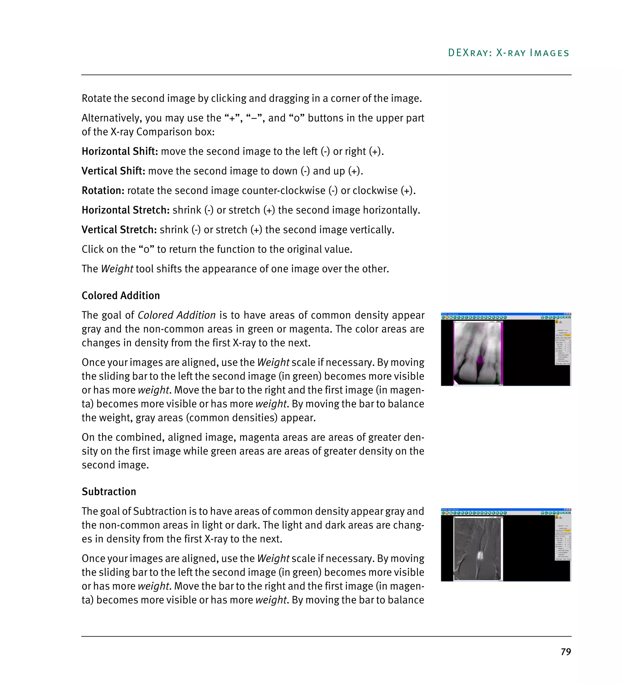 Dexis 9 user manual | PDF