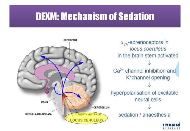 Dexmedetomidine- Pharmacokinetics and clinical Uses.pptx