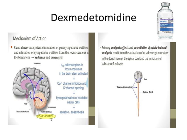 Dexmedetomidine A novel anesthetic agent | PPT