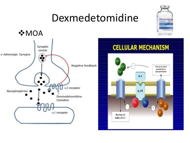 Dexmedetomidine A novel anesthetic agent