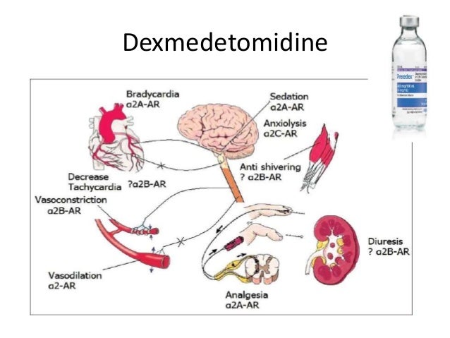 Dexmedetomidine A novel anesthetic agent