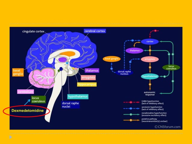 Dexmedetomidine in icu hashemian | PPT