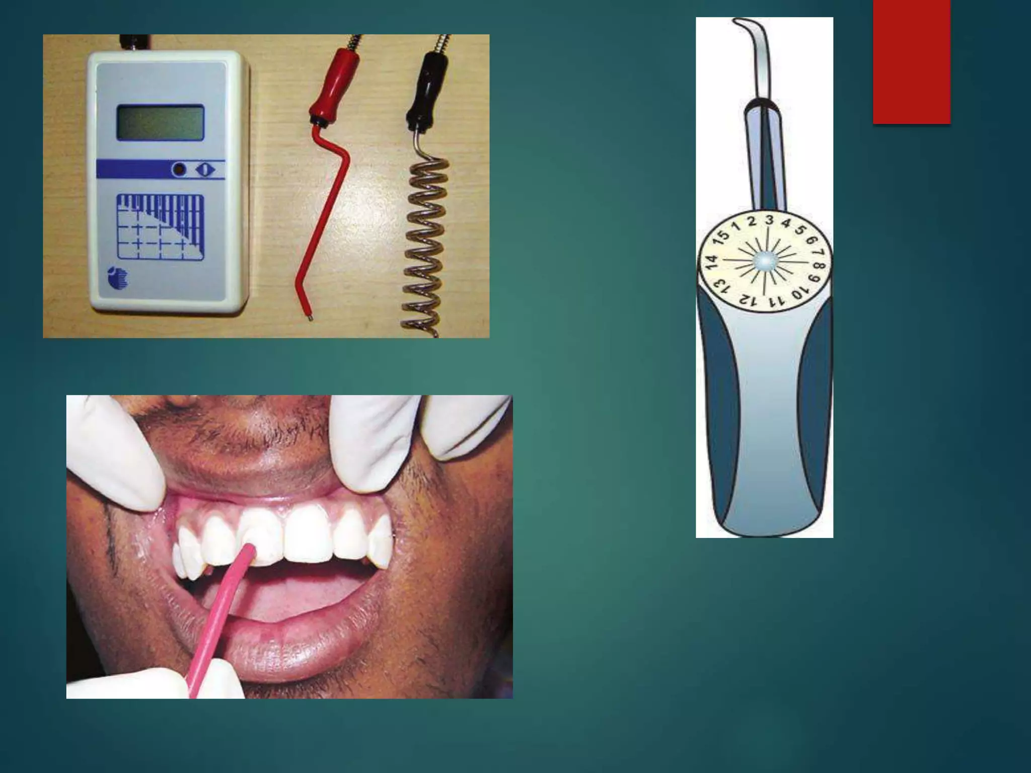 PULP VITALITY TEST.pptx | Dental Health | Diseases and Conditions