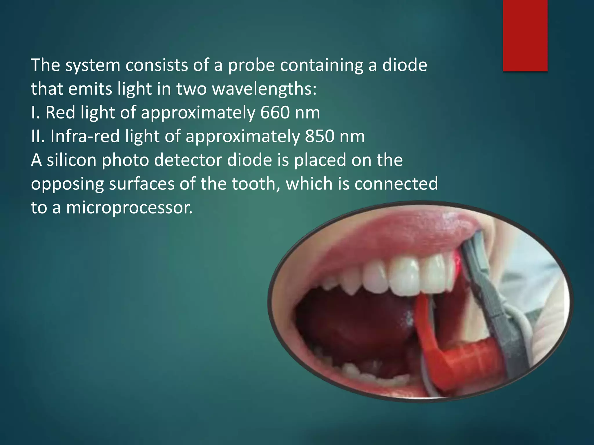 PULP VITALITY TEST.pptx