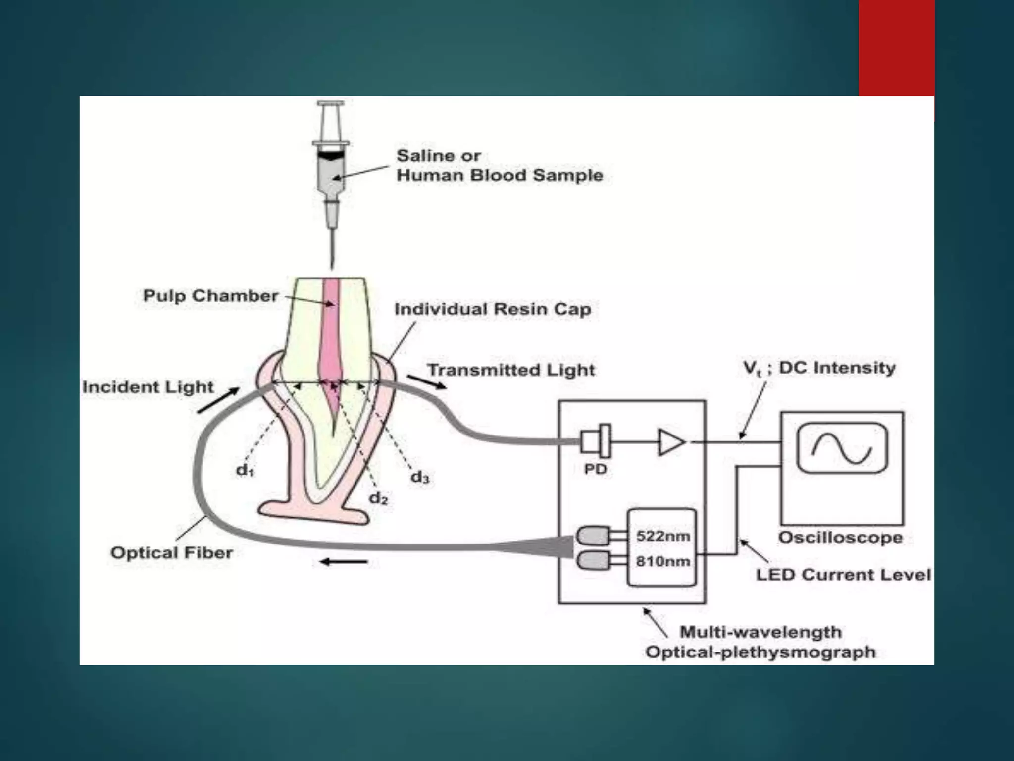 PULP VITALITY TEST.pptx