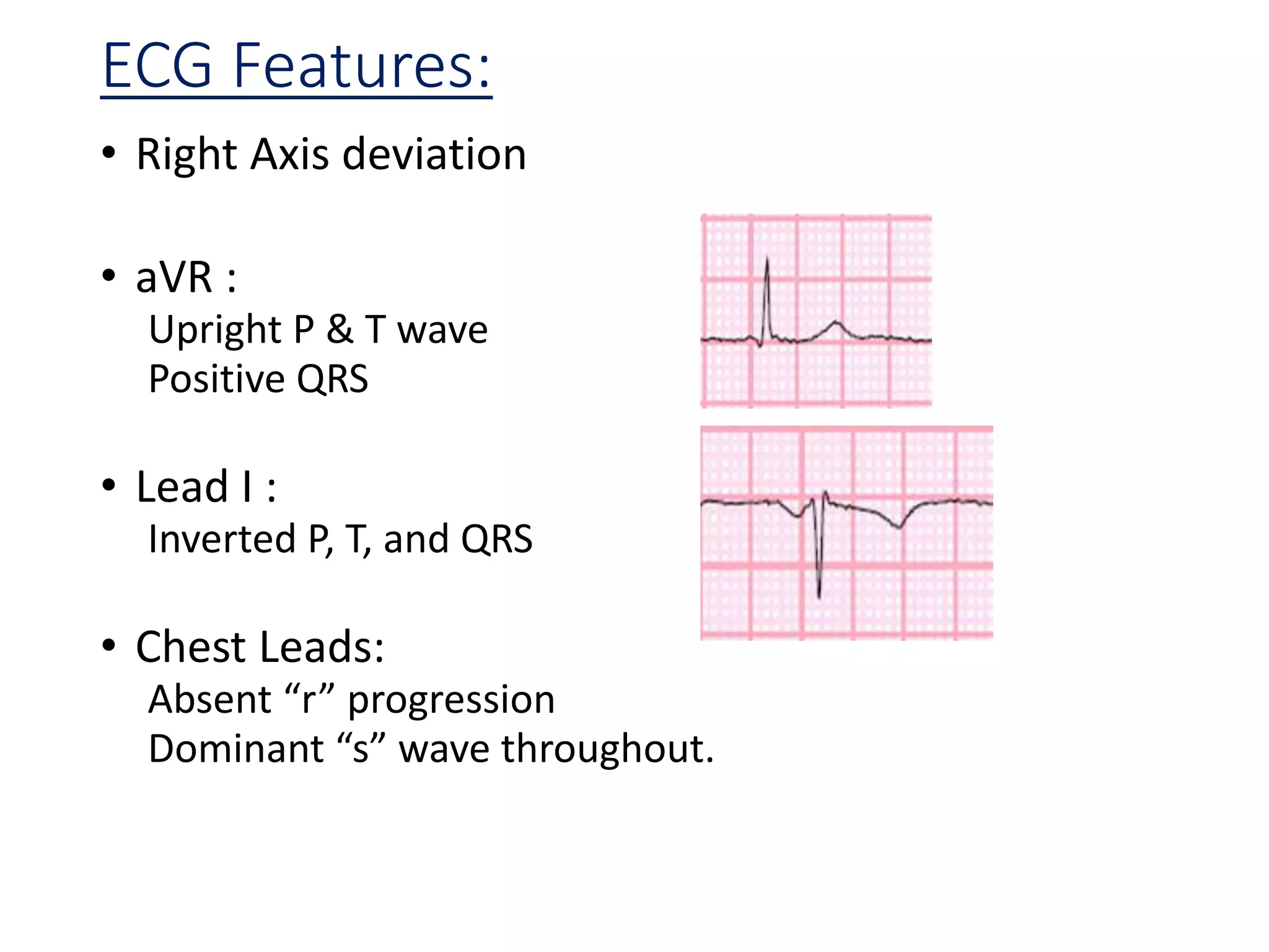 Dextrocardia By Dr. Vaibhav Yawalkar | PPTX