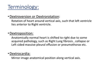 Dextrocardia By Dr. Vaibhav Yawalkar | PPTX