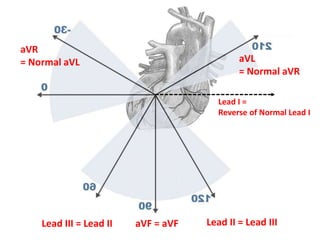 Dextrocardia By Dr. Vaibhav Yawalkar | PPTX