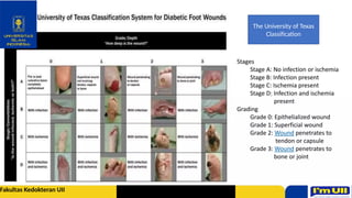 DF-Integrative Management of Diabetic Foot Ulcer.pptx