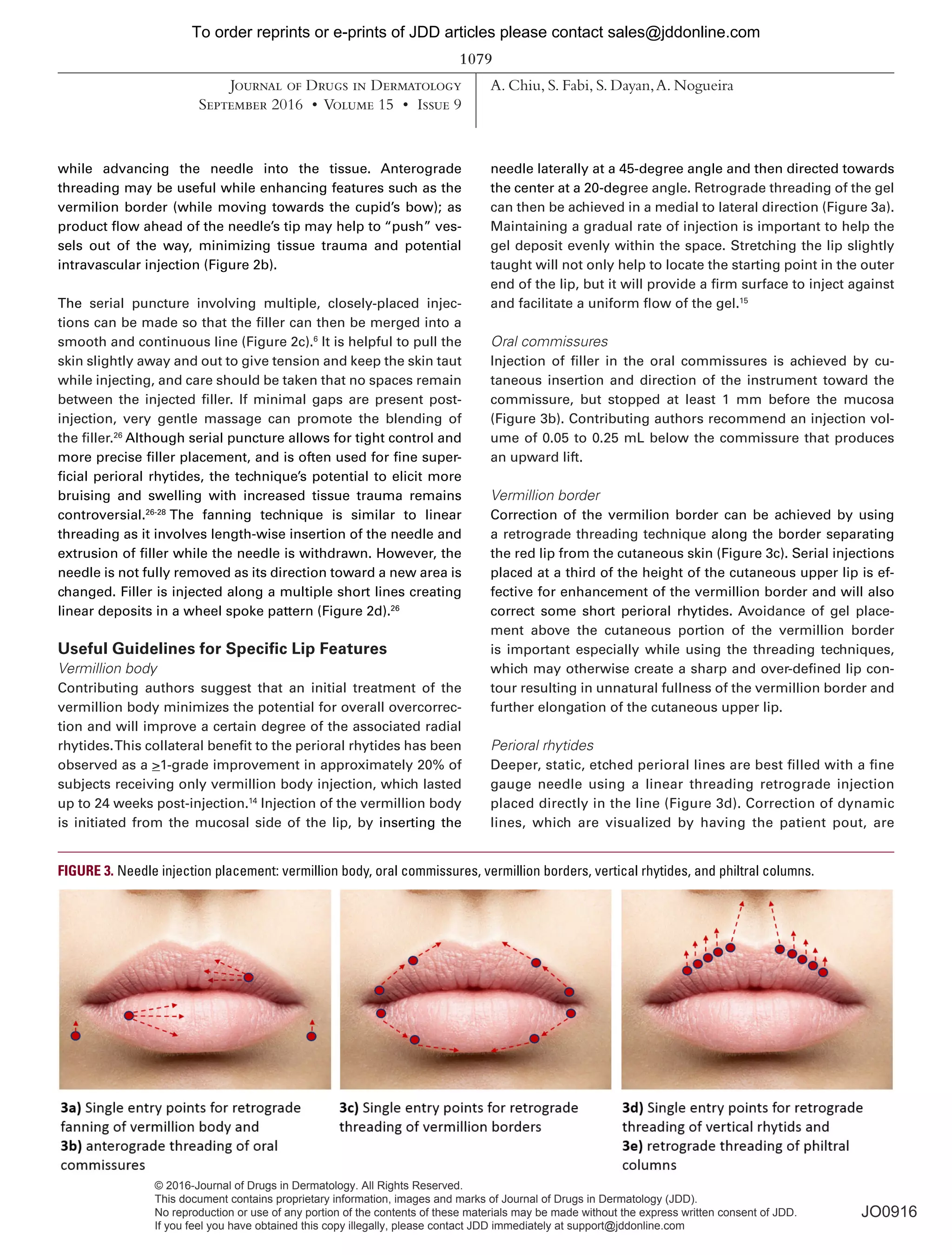 Chiu_2016_Lip Injection Techniques Using Small-Particle Hyaluronic Acid ...