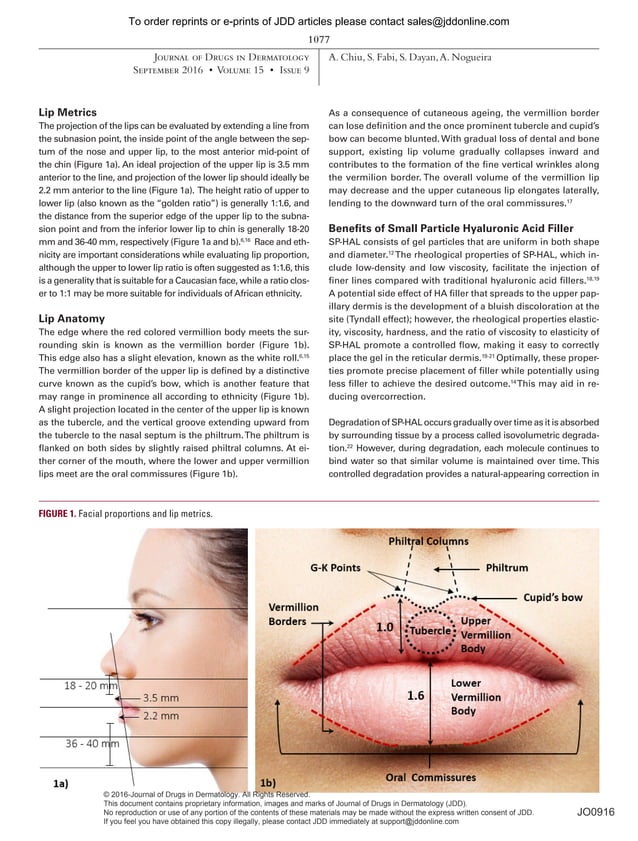 Chiu_2016_Lip Injection Techniques Using Small-Particle Hyaluronic Acid ...