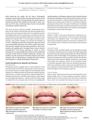 Chiu_2016_Lip Injection Techniques Using Small-Particle Hyaluronic Acid ...