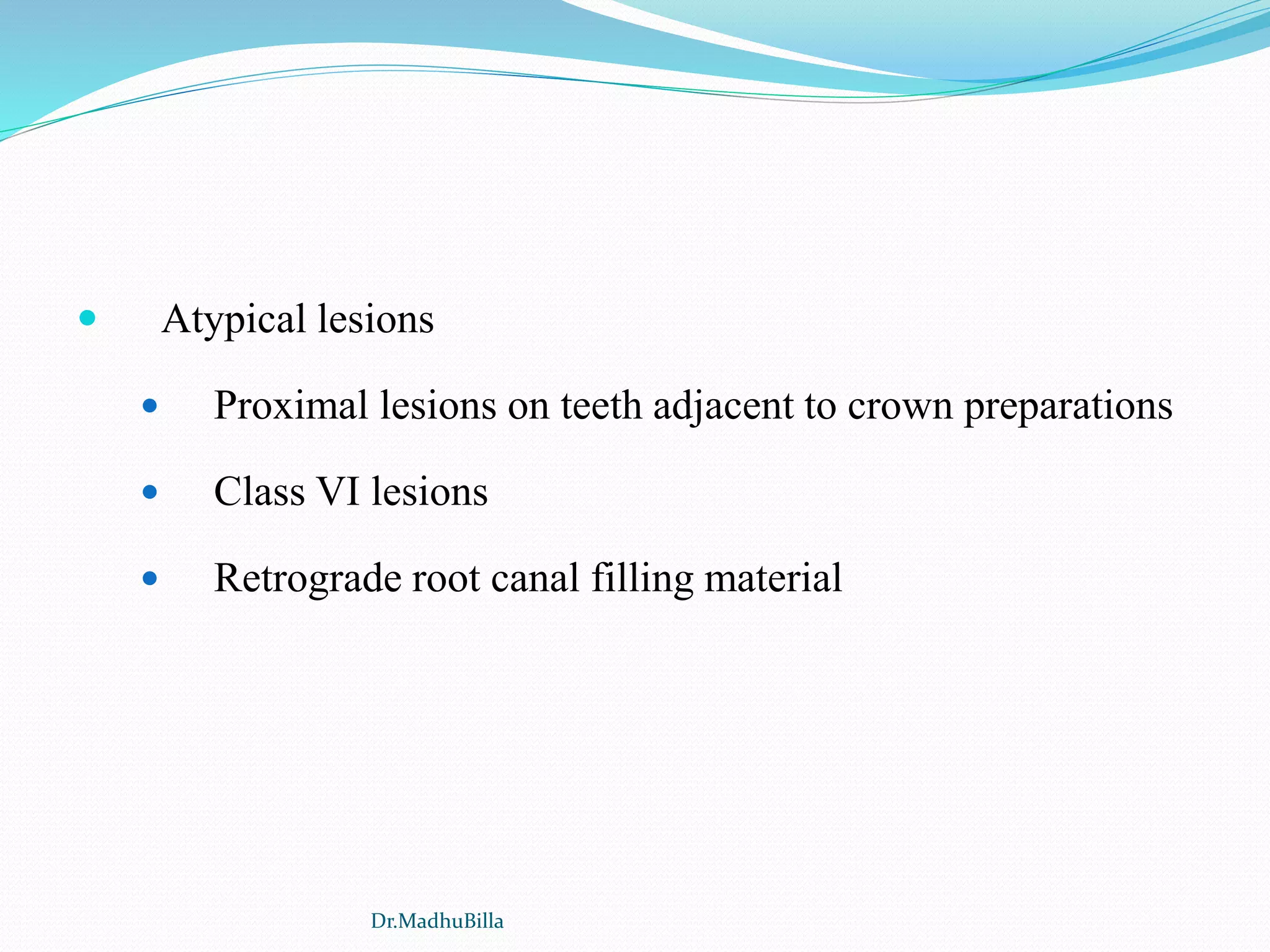 Direct Filling Gold | PPTX