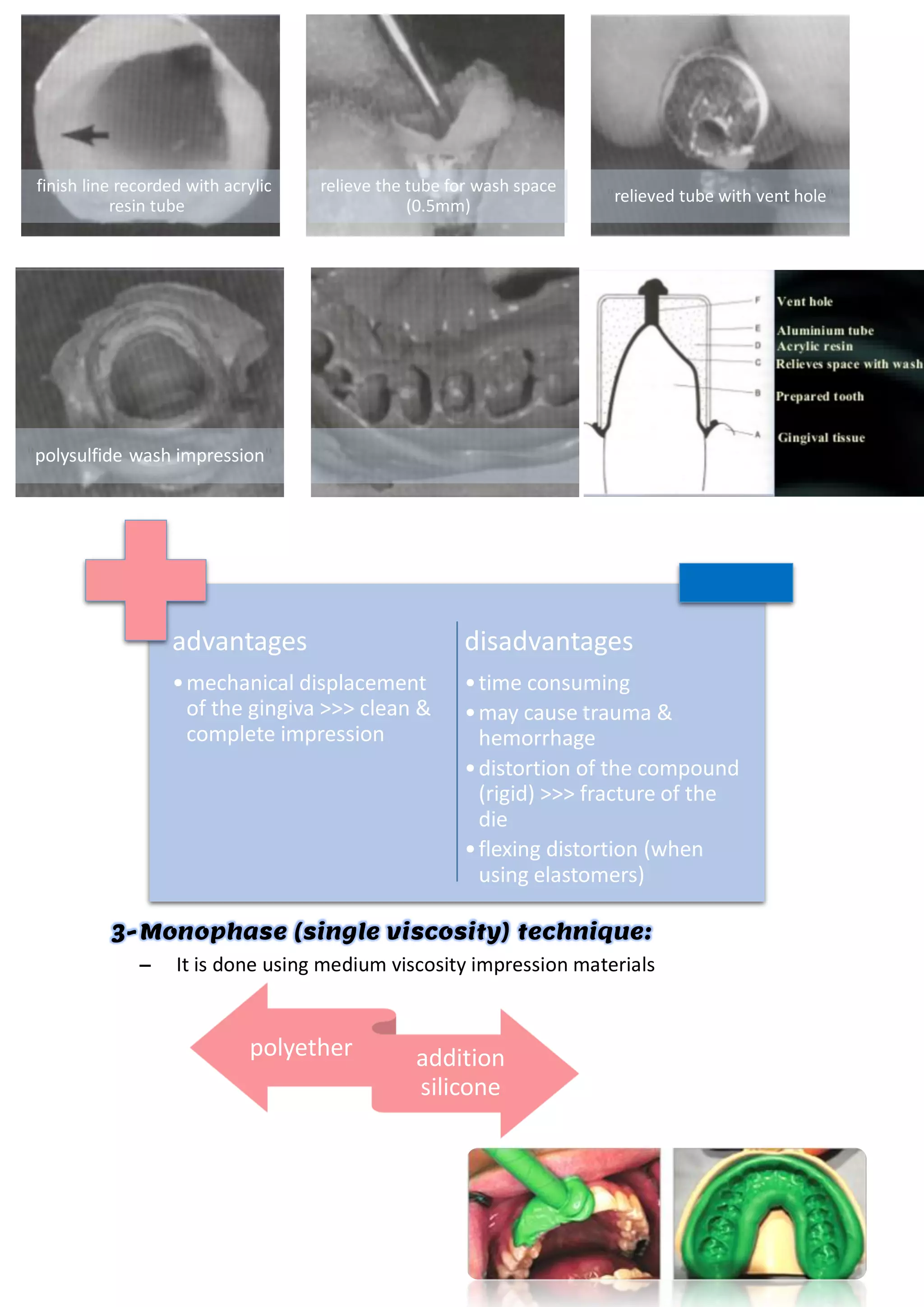 impression techniques for FPD | PDF